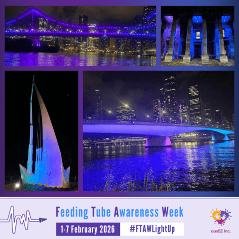 Redlands will light up purple for Feeding Tube Awareness Week